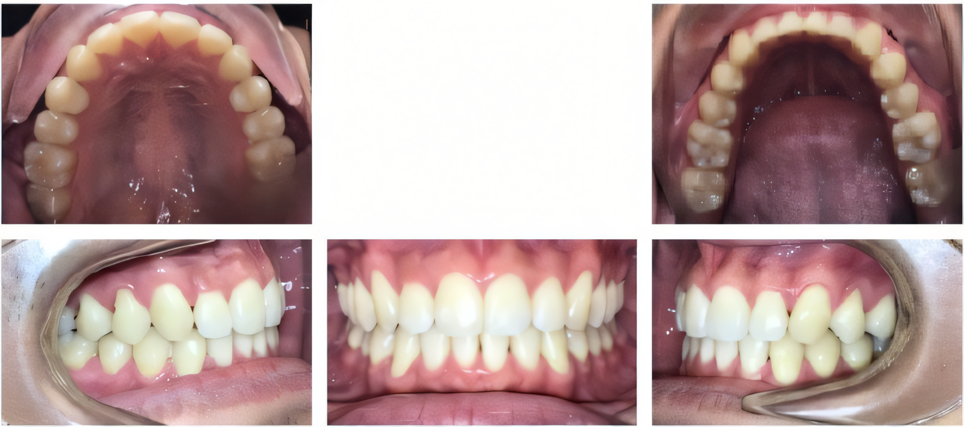 Buffalo Grove Orthodontics